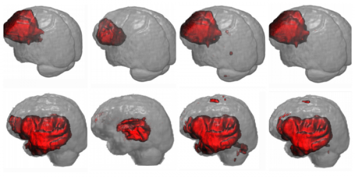 Volumetric Multimodality Neural Network For Brain Tumor Segmentation