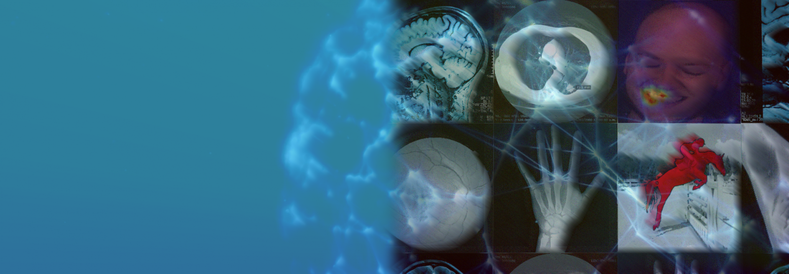 Biomedical Computer Vision – Uniandes