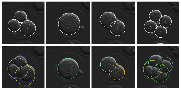 LEARNING TO SEGMENT MOUSE EMBRYO CELLS - Biomedical Computer Vision