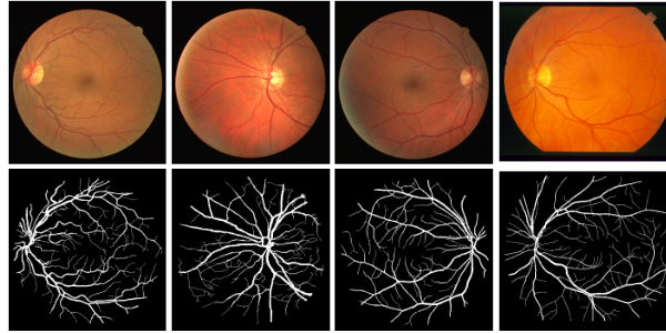 DEEP RETINAL IMAGE UNDERSTANDING - Biomedical Computer Vision