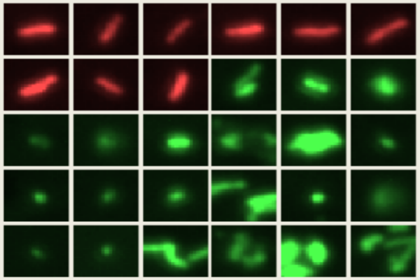 AUTOMATED TUBERCULOSIS DIAGNOSIS - Biomedical Computer Vision